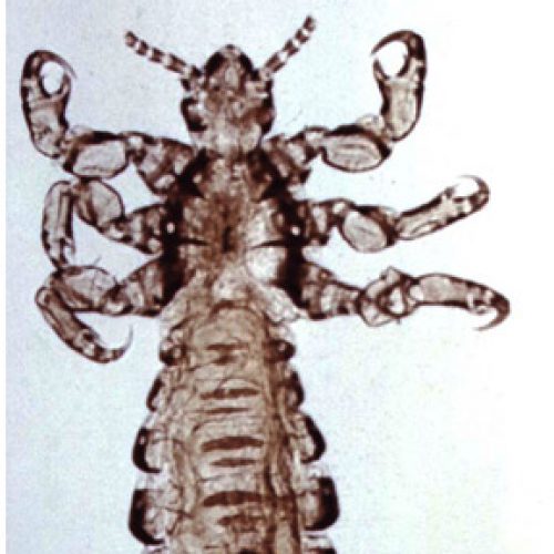 Lice - Encyclopedia of Arkansas
