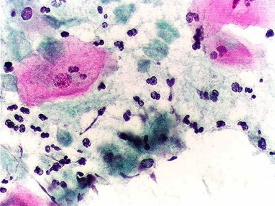Trichomonas - Encyclopedia of Arkansas